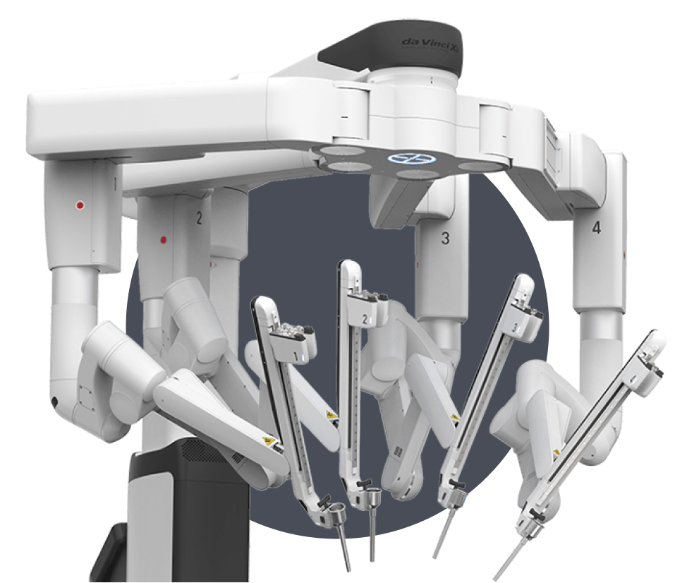 Nossos Robôs de Cirurgia Robótica | Grupo Santa